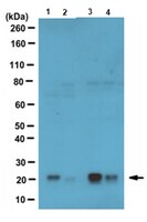 Anti-RBP4 Antibody | ABS568